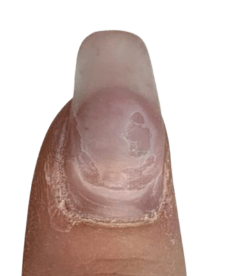 Cause and treatment of pocket lifting – Katie Barnes Tool Range & Education